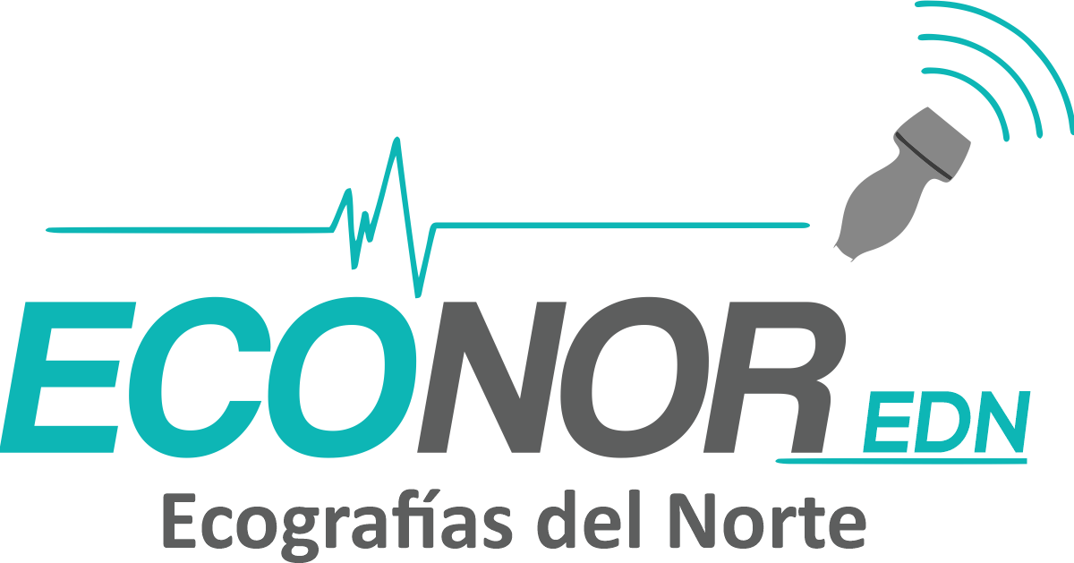 Econor